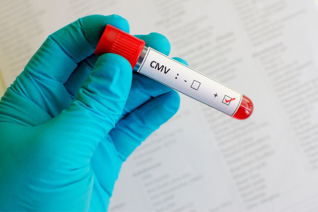 What Is Cytomegalovirus?