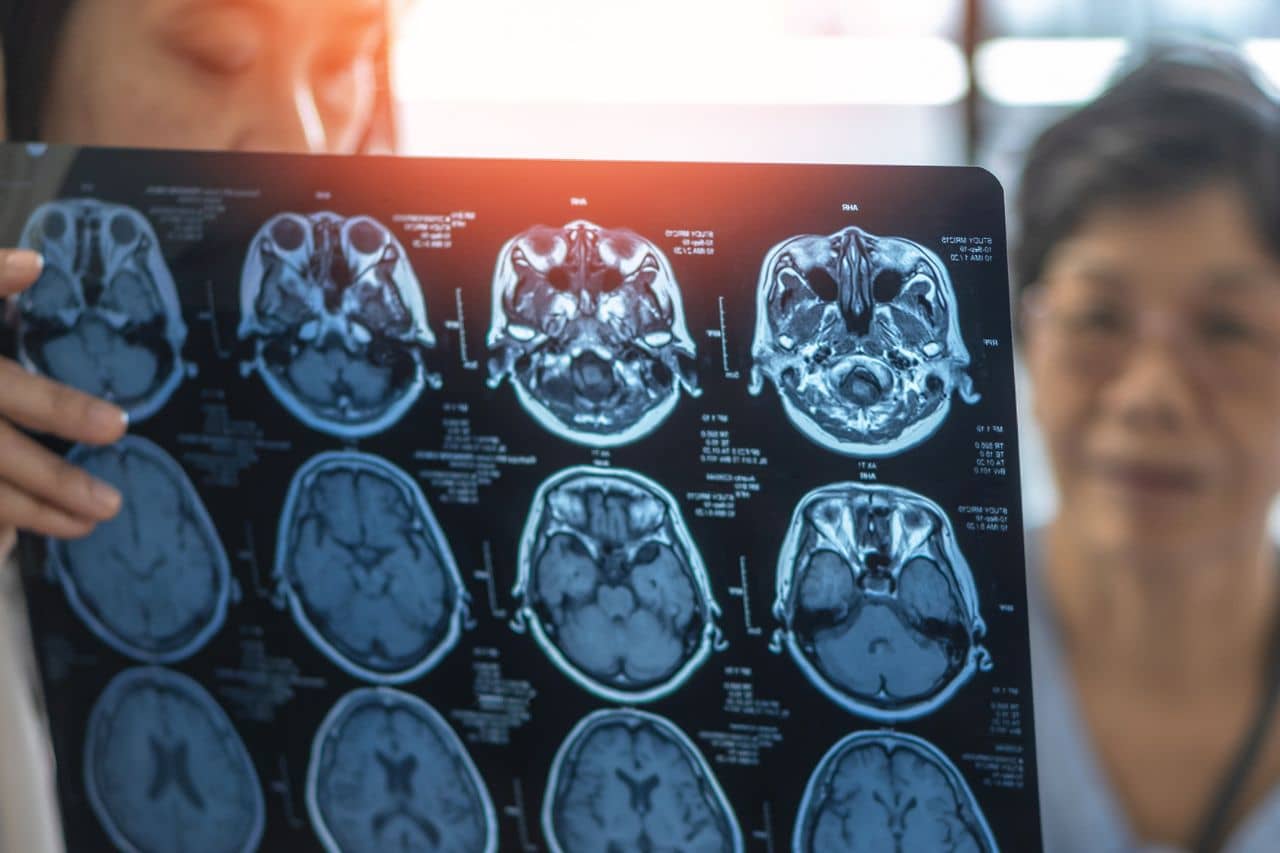 Which Imaging Has The Most Radiation Baptist Health