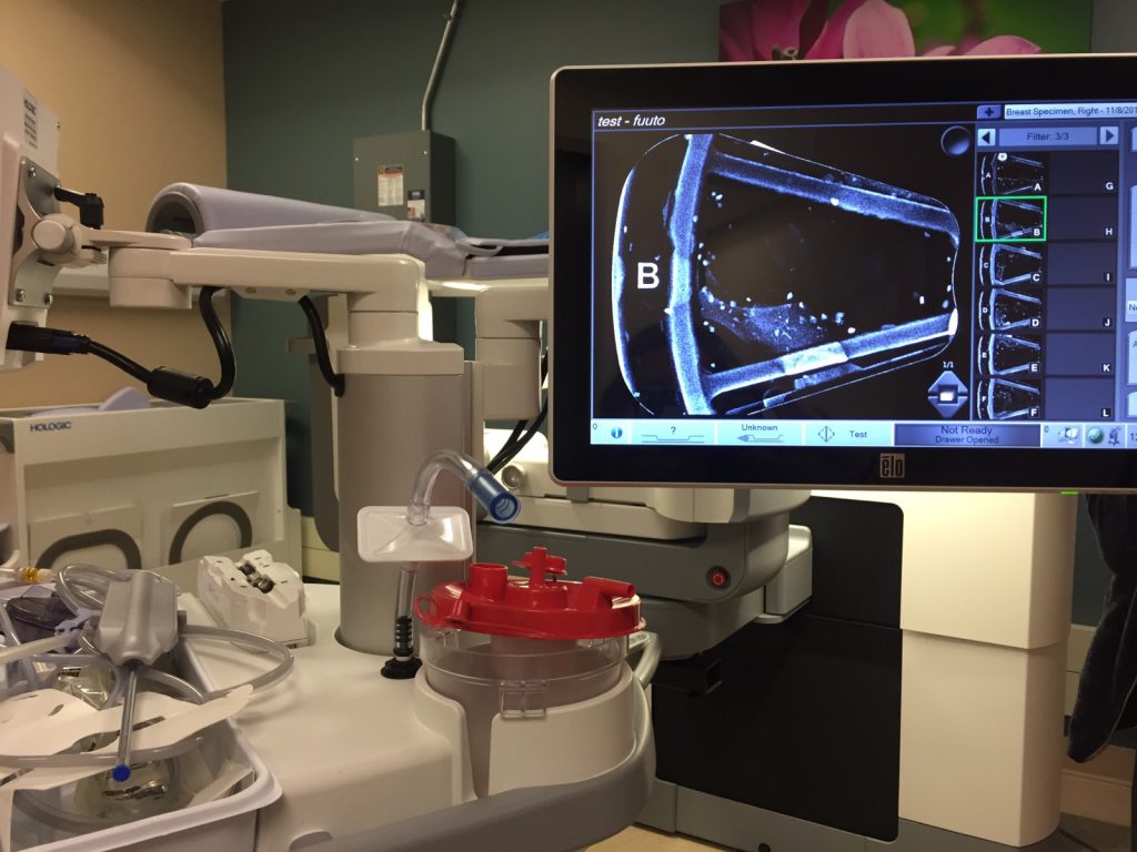 HMH Among First in Nation to Provide Latest Breast Biopsy Technology ...